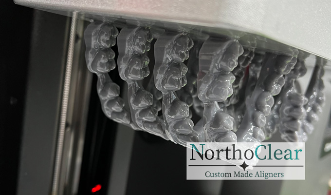 NorthoClear Aligners | In-House Aligner Treatment | Northern Orthodontics